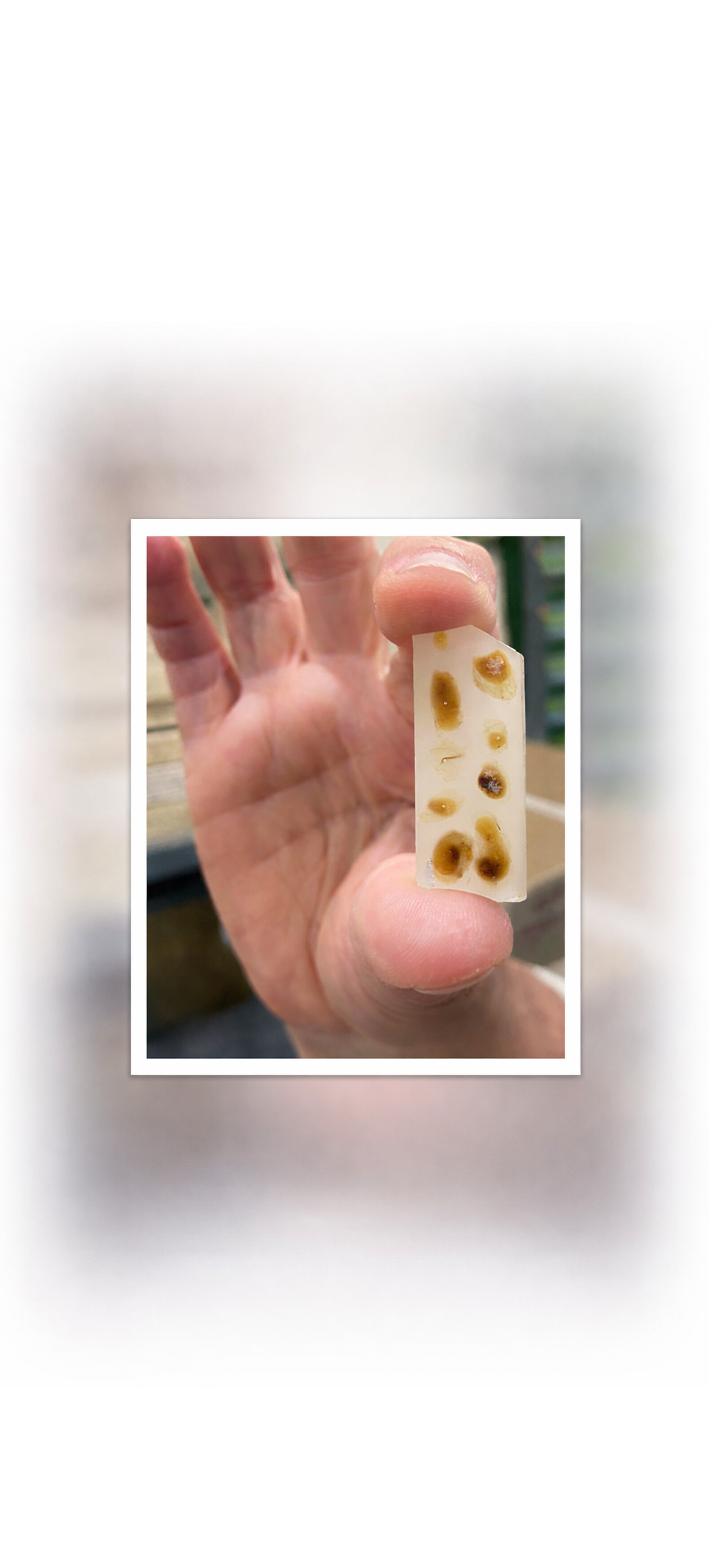 Tumour samples from the 1950s could help unlock the mystery of rising ...