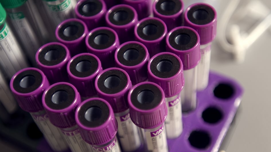 Blood test could spare men with advanced prostate cancer from futile ...