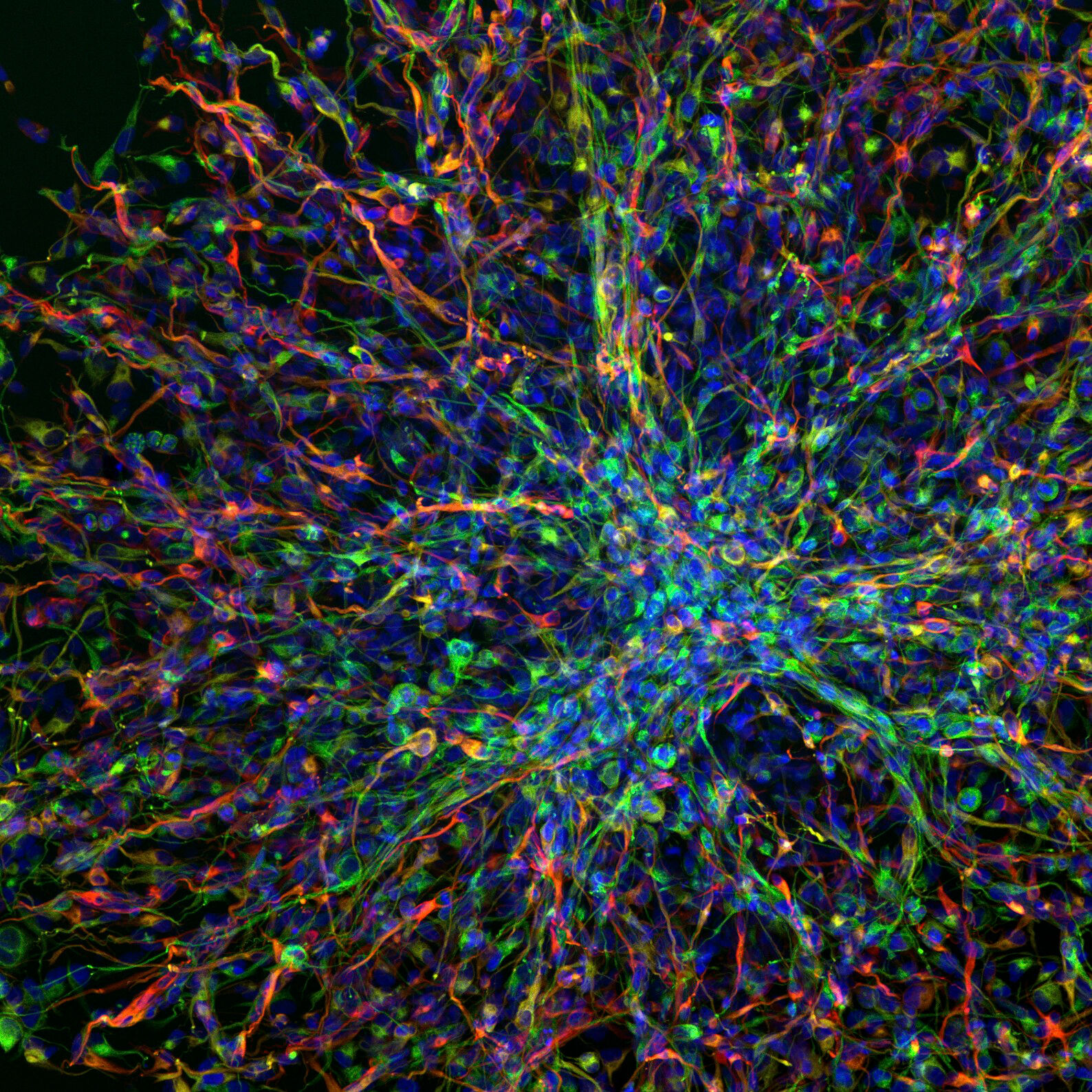 ICR researchers to contribute to £13.7m brain tumour research consortium